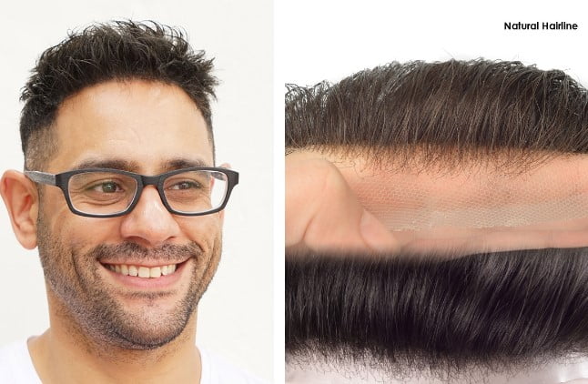 Types Of Hair Systems